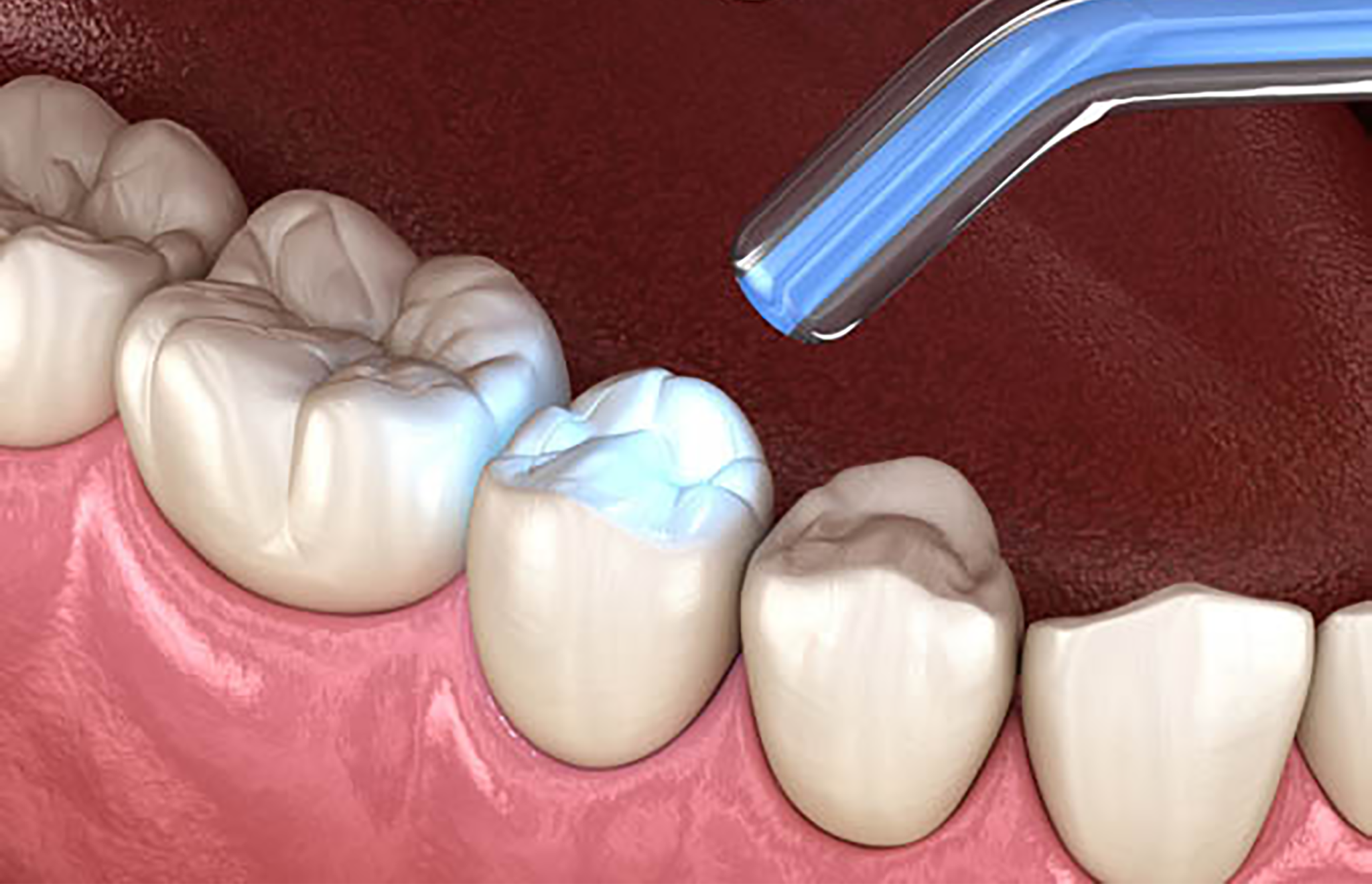 Home - Dr. Soto the Downey Dentist - :- Dr Soto The Downey Dentist